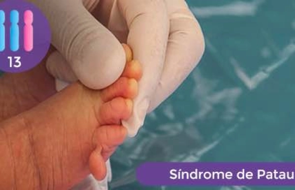 Síndrome de Patau | edredo.com