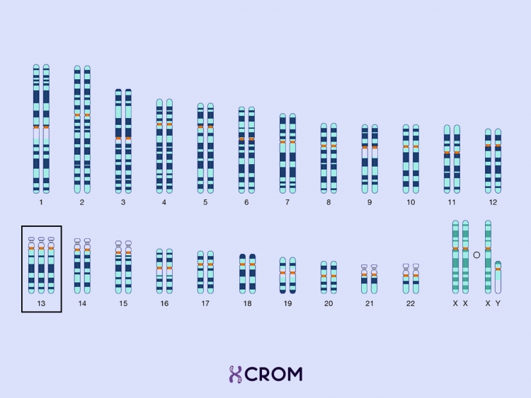 Síndrome de Patau | edredo.com